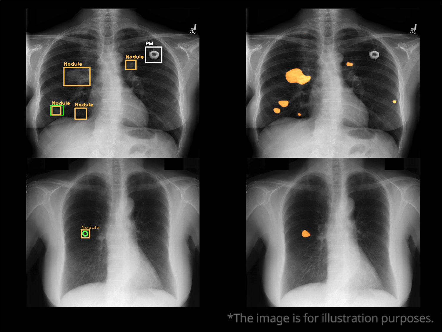 EIRL(エイル) | AI画像診断支援技術 | エルピクセル株式会社
