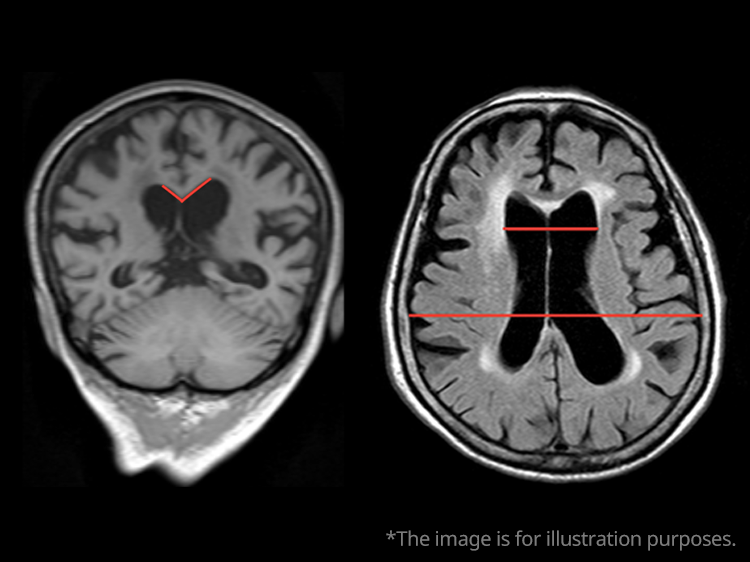 EIRL(エイル) | AI画像診断支援技術 | エルピクセル株式会社