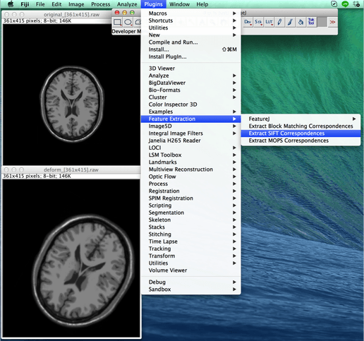 医用画像位置合わせの基礎⑦ 〜Fiji pluginを用いたアフィン変換による画像位置合わせ〜 - EIRL(エイル) | AI画像診断支援技術 | エルピクセル株式会社