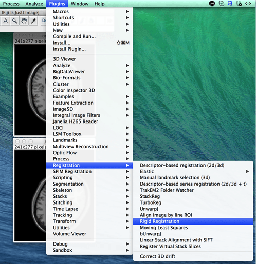 医用画像位置合わせの基礎⑤～Fiji pluginを用いた画像位置合わせ～ - EIRL(エイル) | AI画像診断支援技術 | エルピクセル株式会社