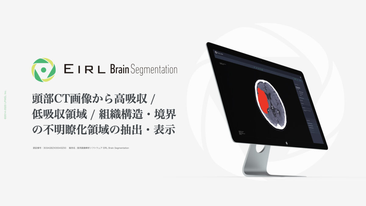 EIRL Brain Segmentation、頭部CT画像から 高吸収／低吸収領域及び組織構造・境界の不明瞭化がみられる領域の 抽出・表示が可能となった新モデルをリリース - EIRL ...