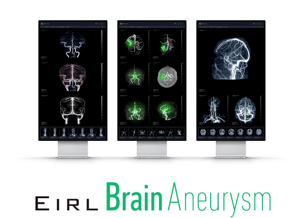 EIRL Brain Aneurysm - EIRL | NEXT MEDICAL VISION | LPIXEL Inc.