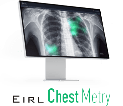 EIRL Brain Aneurysm - EIRL | NEXT MEDICAL VISION | LPIXEL Inc.