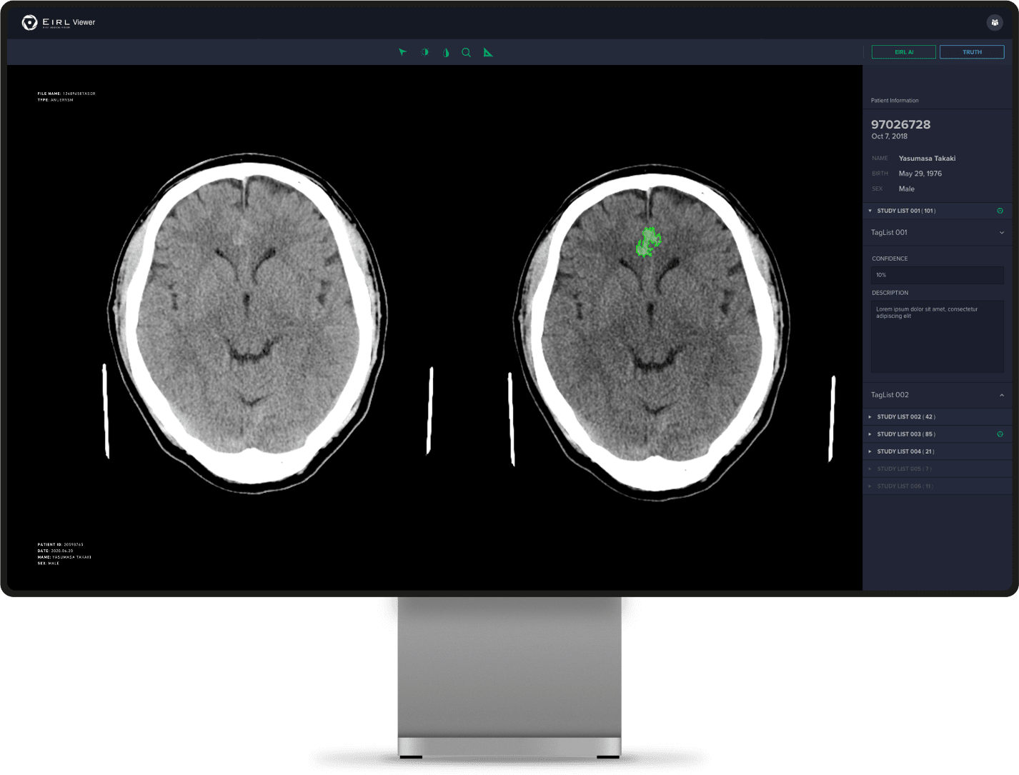 EIRL | NEXT MEDICAL VISION | LPIXEL Inc. - Another set of powerful eyes to support future ...