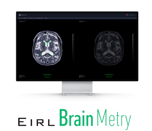 EIRL Brain Metry - EIRL(エイル) | AI画像診断支援技術 | エルピクセル株式会社