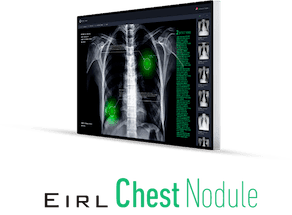 EIRL Brain Metry - EIRL(エイル) | AI画像診断支援技術 | エルピクセル株式会社