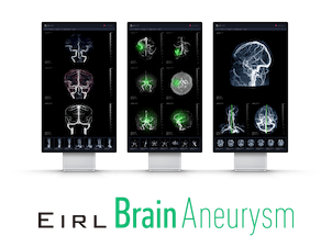 EIRL Brain Aneurysm - EIRL(エイル) | AI画像診断支援技術 | エルピクセル株式会社