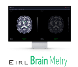 EIRL Brain Metry - EIRL(エイル) | AI画像診断支援技術 | エルピクセル株式会社