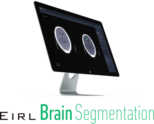 ストーリー - EIRL(エイル) | AI画像診断支援技術 | エルピクセル株式会社