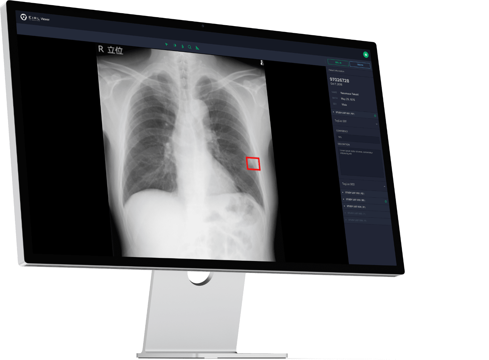 EIRL(エイル) | AI画像診断支援技術 | エルピクセル株式会社 - EIRL（エイル）は、CT, MRI, 病理画像などの医療画像を中心に多様な医療ビックデータを活用し、独自の人工知能 ...