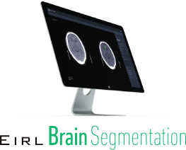 研究開発 - EIRL(エイル) | AI画像診断支援技術 | エルピクセル株式会社