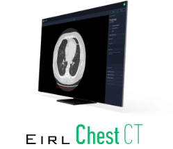 EIRL Chest Screening - EIRL(エイル) | AI画像診断支援技術 | エルピクセル株式会社
