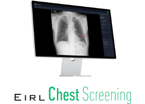 EIRL Chest Screening - EIRL(エイル) | AI画像診断支援技術 | エルピクセル株式会社